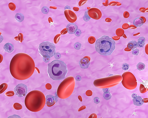 Sindrom Myelodysplastic (MDS)
